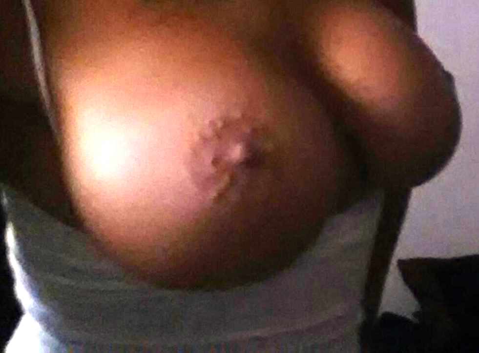 Cold Porn Pic Eporner