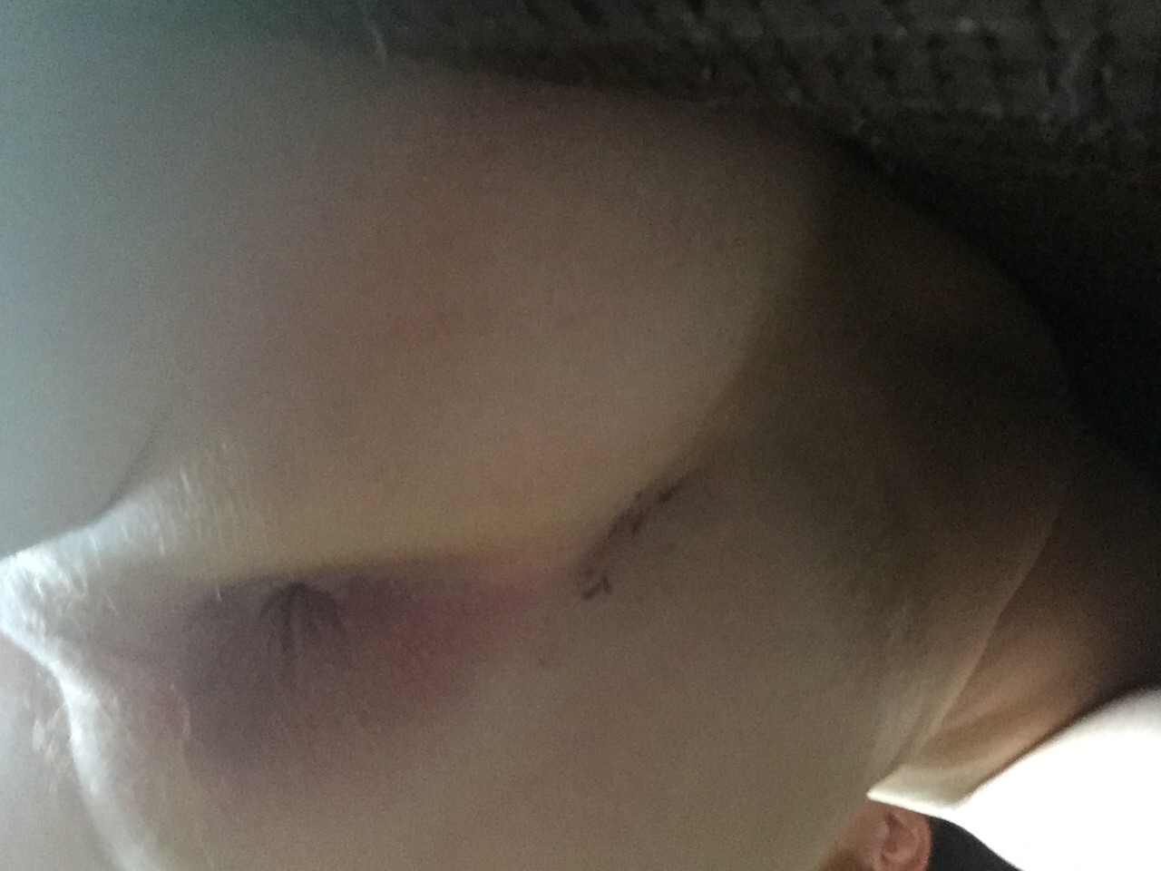 Face Skin Lip Nose Cheek Chin Porn Pic Eporner